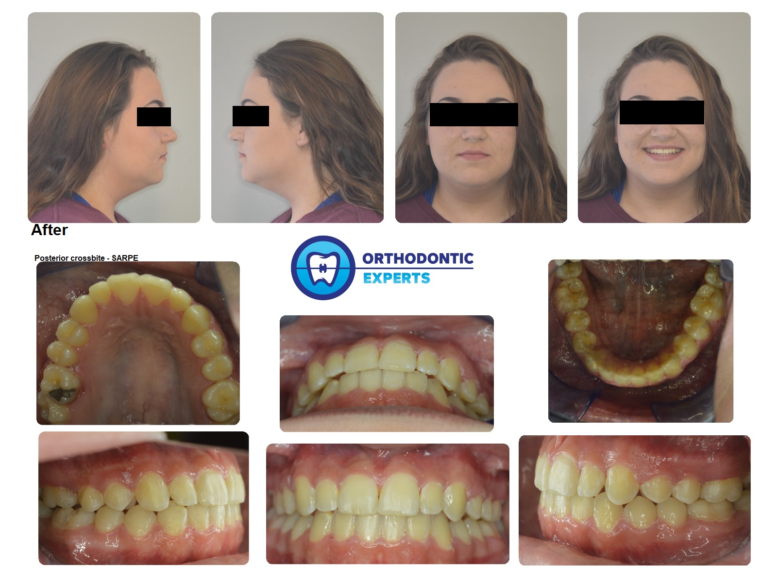 2RPE | Top Orthodontist: Braces, Invisalign