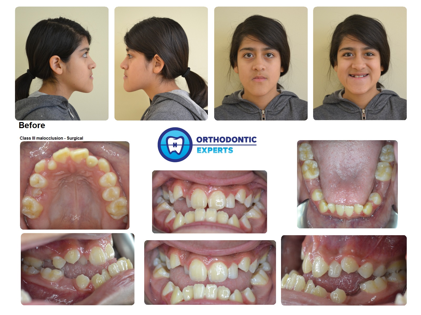 3.Surgical | Top Orthodontist: Braces, Invisalign