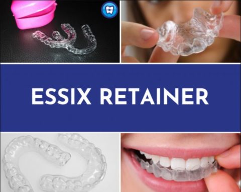 Essix Retainer, How it works and How to Essix Retainer Care