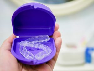 Essix Retainer, How it works and How to Essix Retainer Care