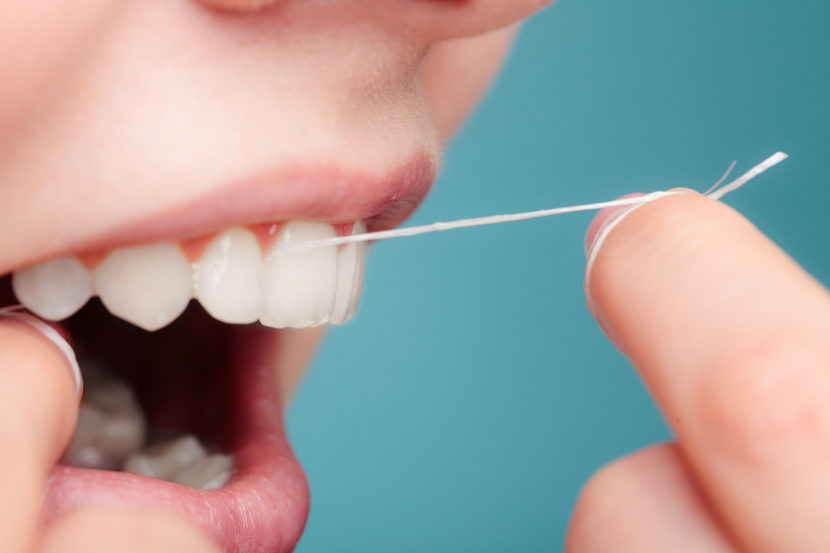 A Permanent Retainer for Permanent Smile | Pros, Cons and Cost