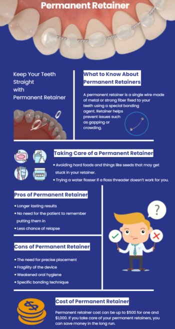 A Permanent Retainer for Permanent Smile | Pros, Cons and Cost