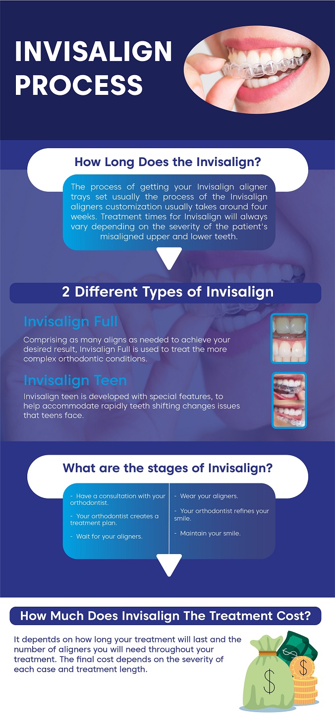 How Long Does Invisalign Take Invisalign Process