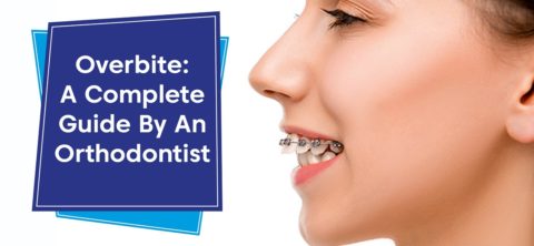 Overbite: A Complete Guide By An Orthodontist - Orthodontic Experts