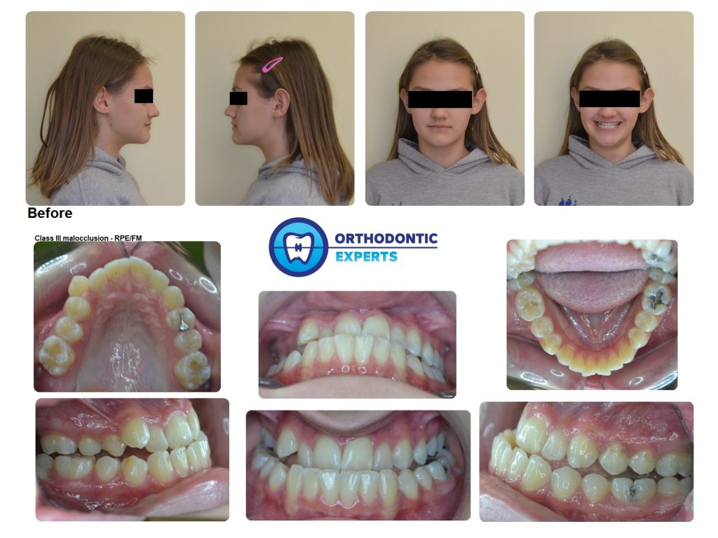 Before & After Gallery | Post and Pre-Treatment Results