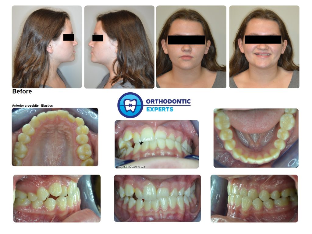 Before & After Gallery | Post and Pre-Treatment Results