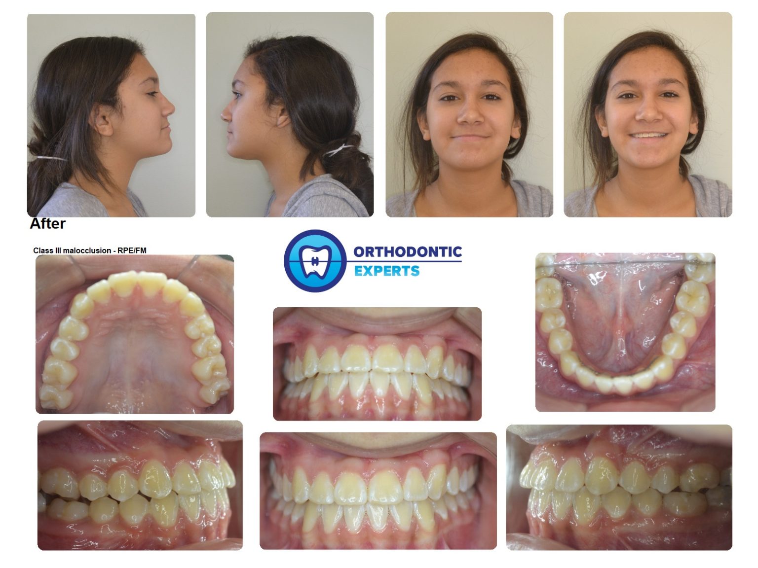 Before & After Gallery | Post and Pre-Treatment Results