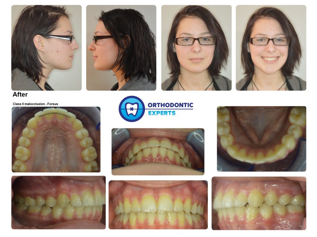 Before & After Gallery | Post and Pre-Treatment Results