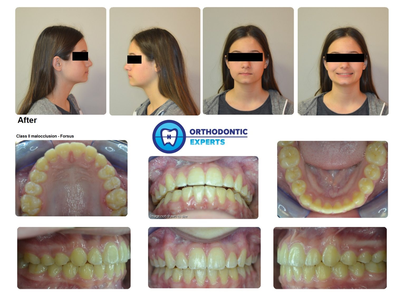 Before & After Gallery | Post and Pre-Treatment Results
