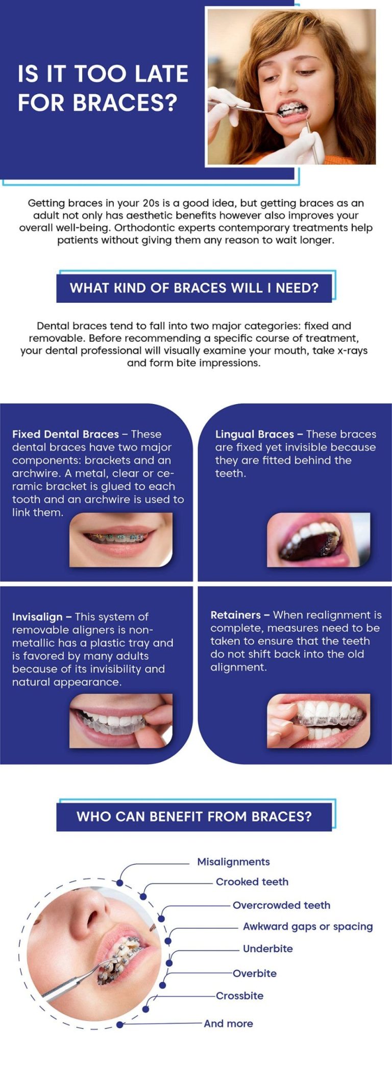 When is it Too Late to Get Braces? Orthodontic Experts