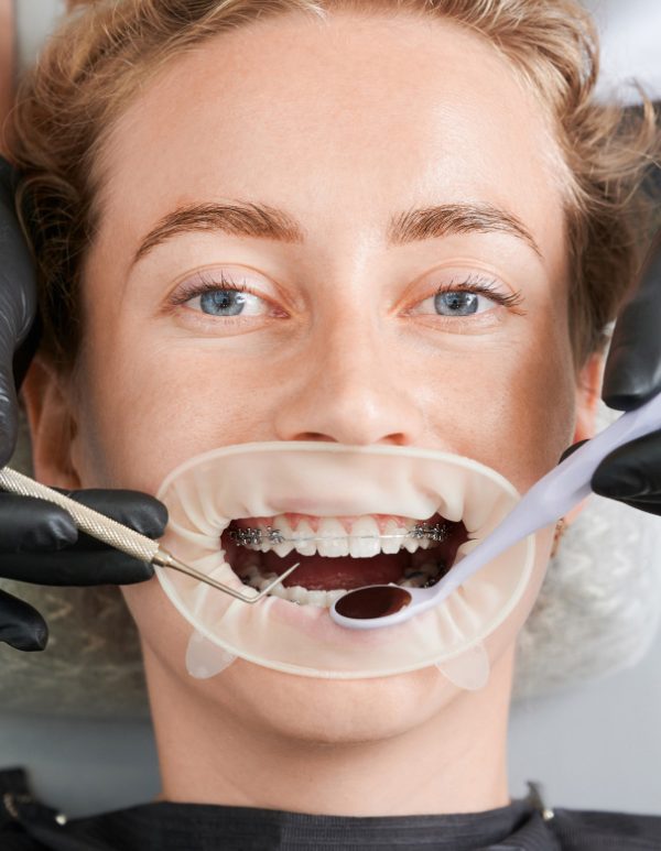 Signs You Need Orthodontic Treatment | Common Conditions