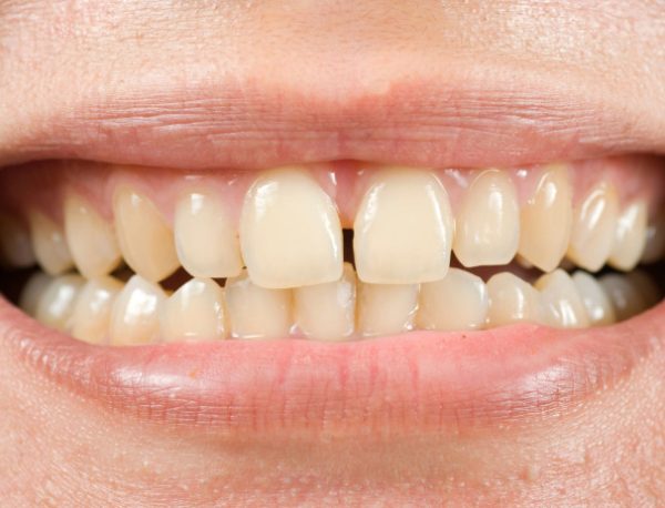 Signs You Need Orthodontic Treatment | Common Conditions