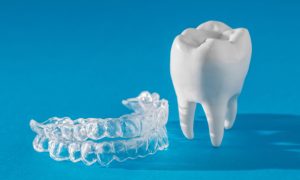 Vivera Retainers | Benefits of Vivera Retainers & Cost