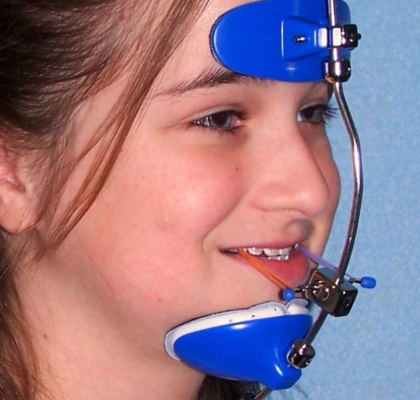 Orthodontic Appliances - Braces and Clear Aligners