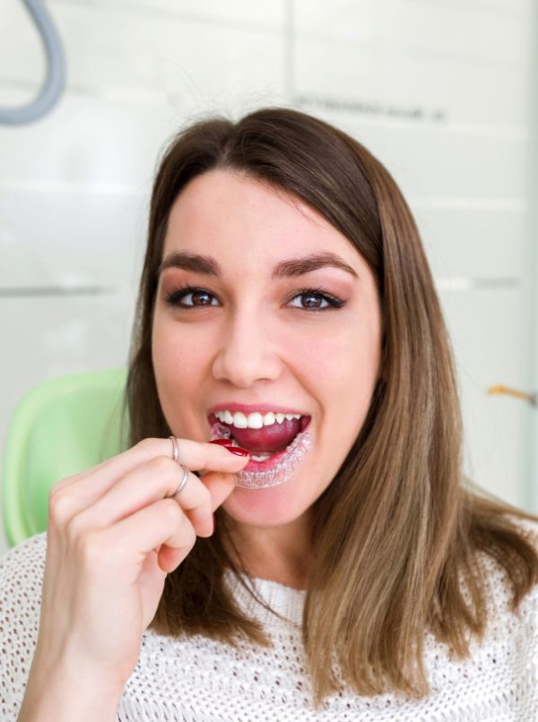 Essix Retainer, How it works and How to Essix Retainer Care