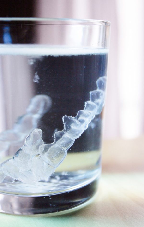 Vivera Retainers | Benefits of Vivera Retainers & Cost