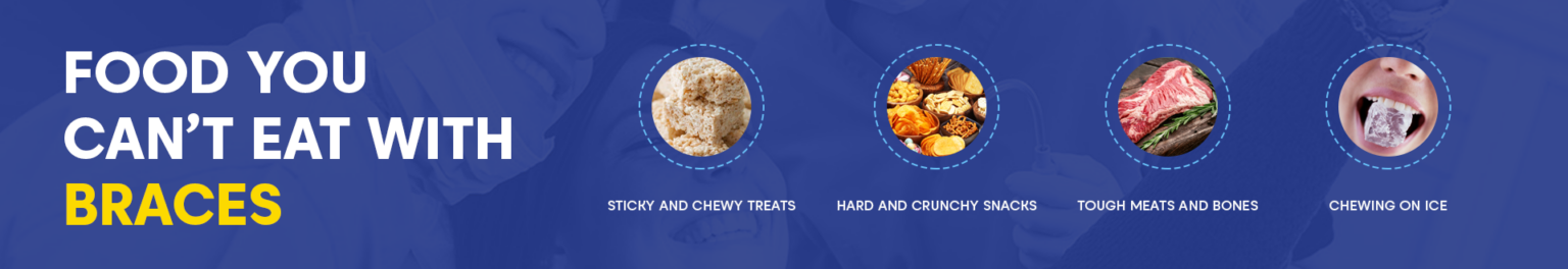 Thanksgiving Foods Safe for Braces: Your Essential Guide