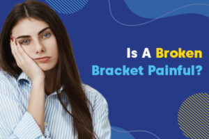 A Comprehensive Guide To Broken Braces Brackets