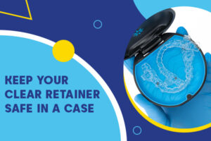 7 Essential Facts About Clear Plastic Retainers