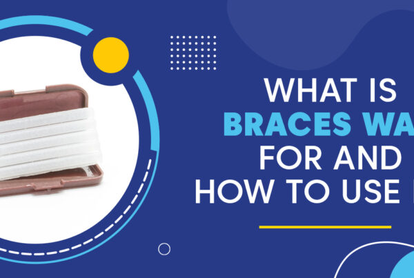 How to Brush Your Teeth with Braces – Step by Step Guide