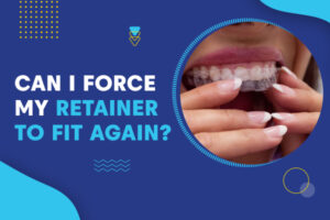 What To Do If My Retainer Doesn't Fit Anymore? A Guide!