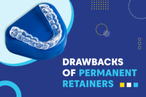 Permanent Retainer vs. Removable Retainer - Orthodontic Experts