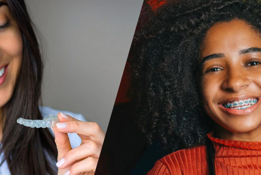 Using Spacers for Braces: What You Need to Know